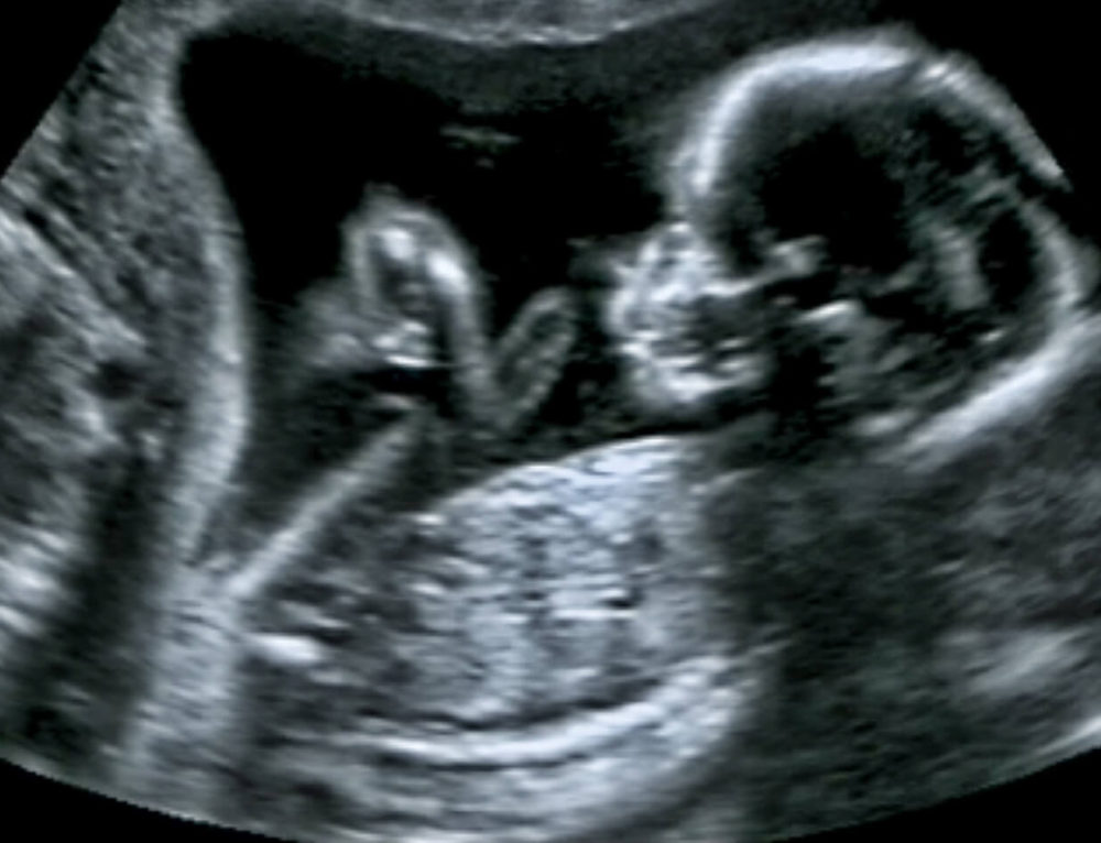 Radiografía de tórax: qué es y donde practicártela en Bogotá - REDIMED